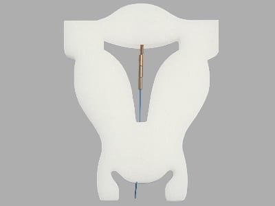 GyneFix İle Tanışın – GyneFix